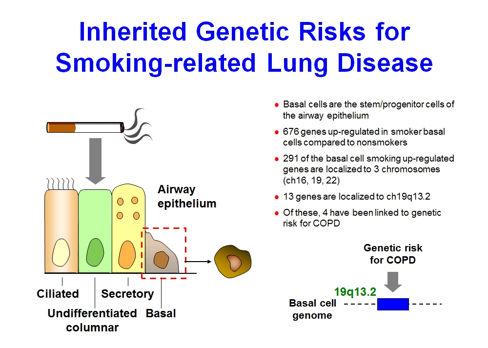 Researchers Reveal Link Between COPD Risk Genes and Lung Cells ... Researchers Reveal Link Between COPD Risk Genes and Lung Cells ...