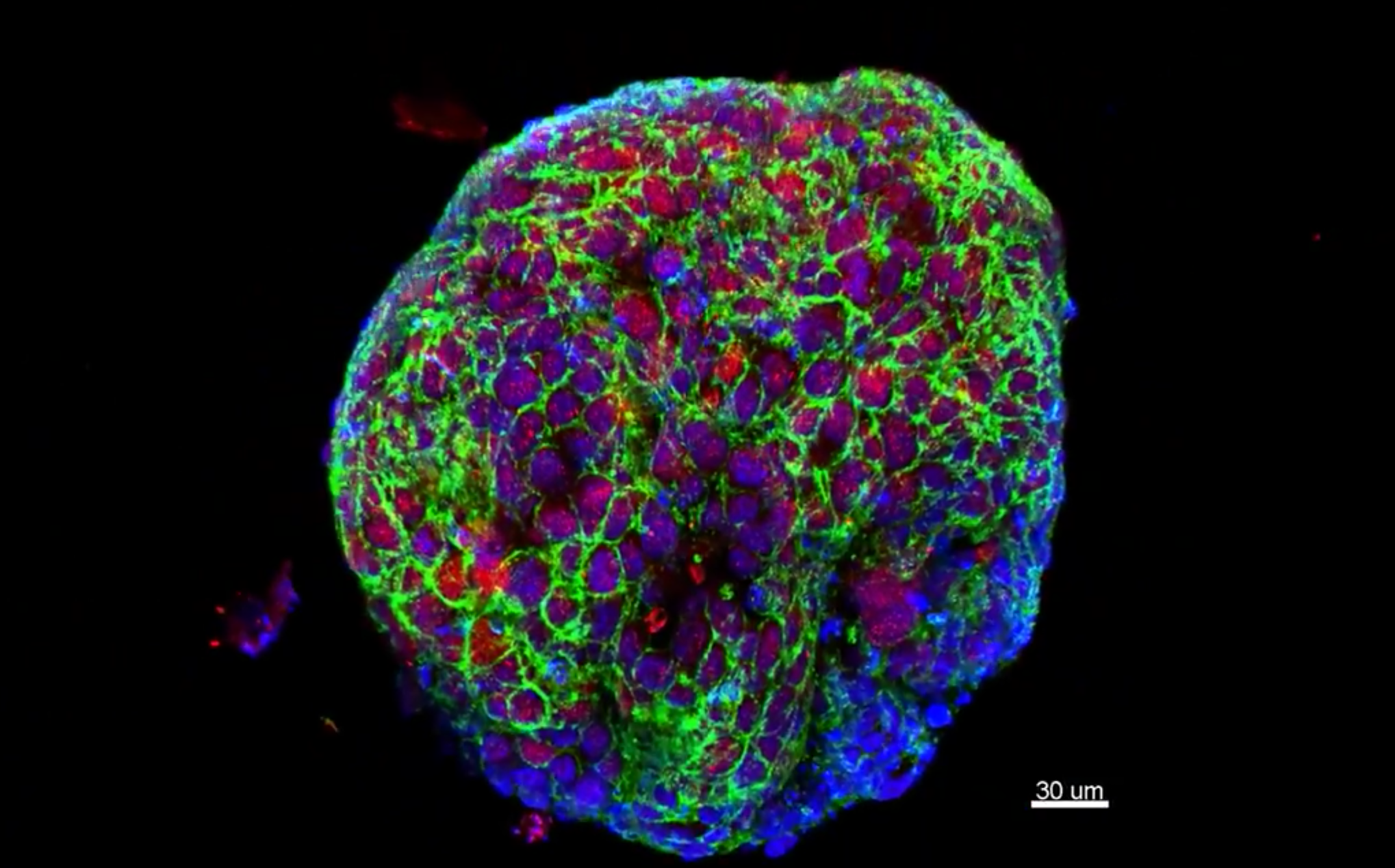 Three-Pronged Approach Key to Precision Medicine | Newsroom | Weill ...