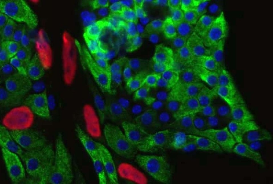Boosting Beta Cells to Treat Type 2 Diabetes | Newsroom | Weill Cornell ...