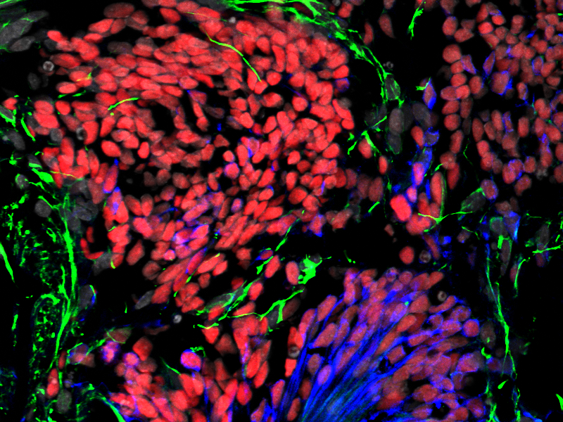 Stem Cell-Based Genomic Study Yields Insights on Viral Infection ...