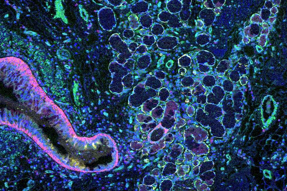 New Computational Method Builds Detailed Maps of Human Tissues ...