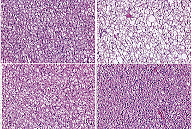 Scientists Gain Insight into the Mechanisms of Fat Burning and Storage ...