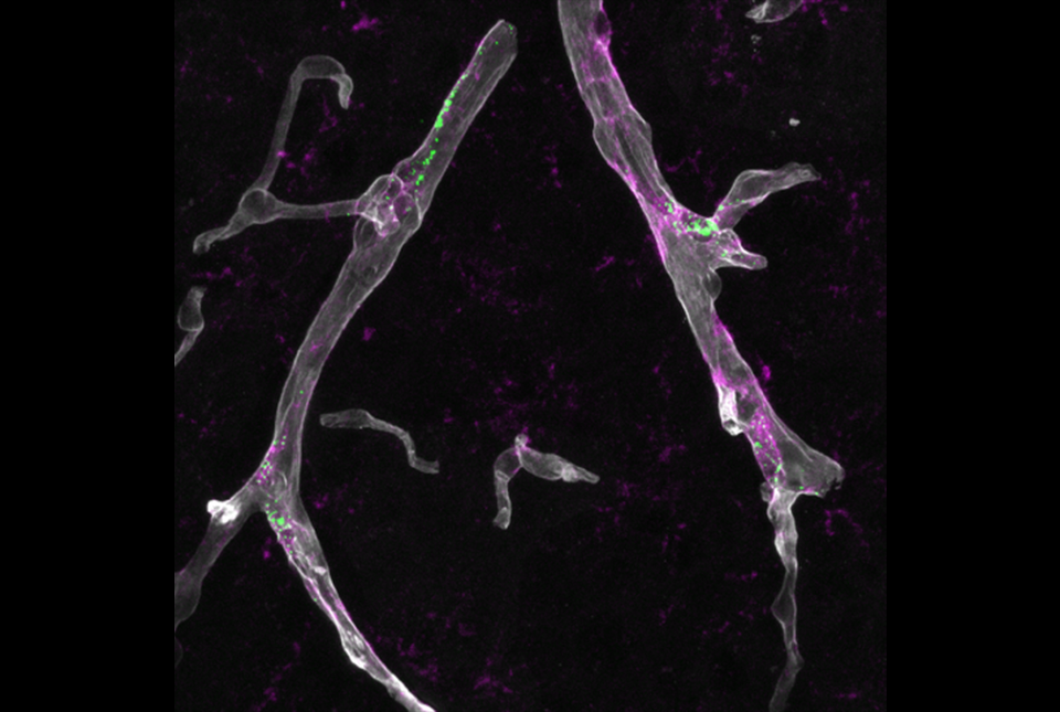 Brain Macrophages with ApoE4 Play a Key Role in Damaging Blood Vessels ...