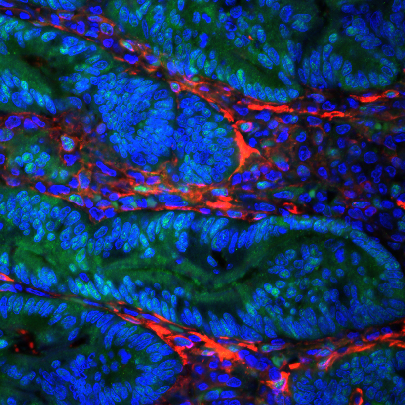 Research Reveals Why Some Tumors Have Different Makeup of Cells ... Research Reveals Why Some Tumors Have Different Makeup of Cells ...
