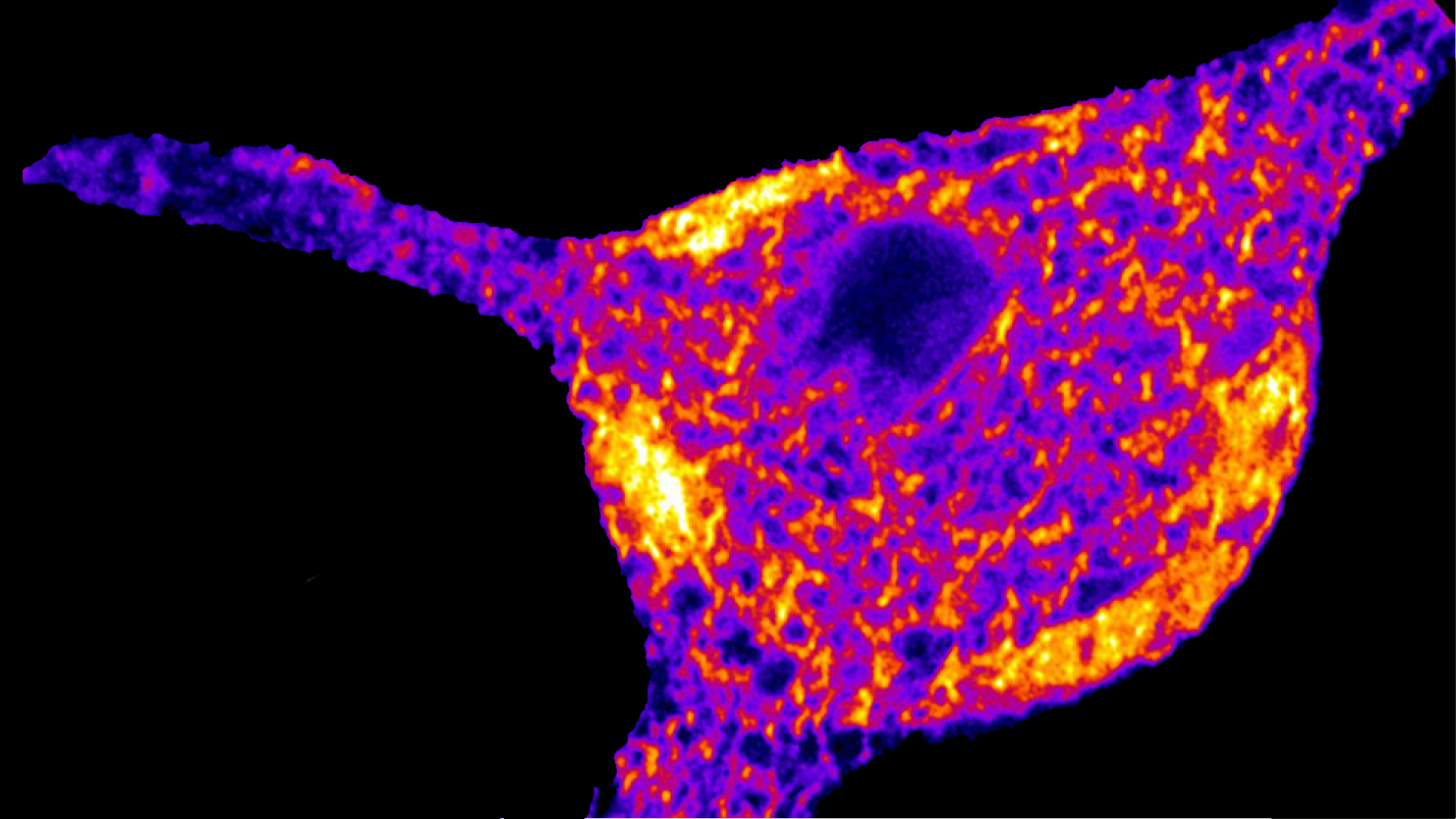 Researchers Discover New Mechanism of Synapse Control | Newsroom ...