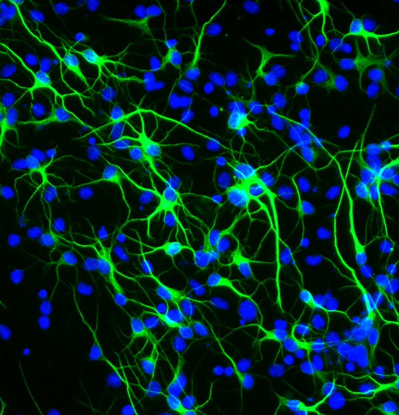 Study Reveals How a Longevity Gene Protects Brain Stem Cells From ...