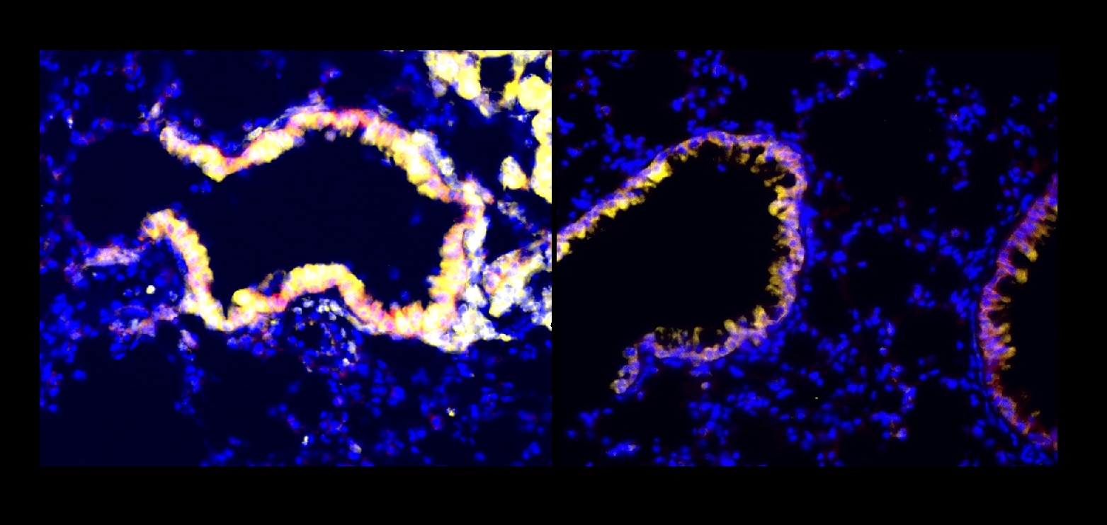 Scientists Find a New Way to Reverse Immune Suppression in Tumors ...