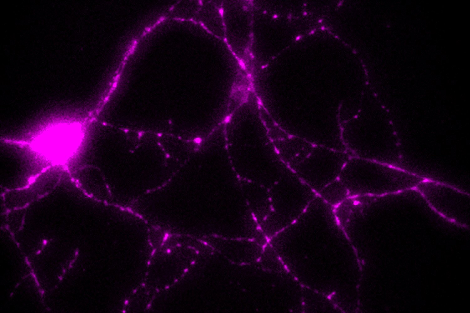 The Role of an Energy-Producing Enzyme in Treating Parkinson’s Disease ...