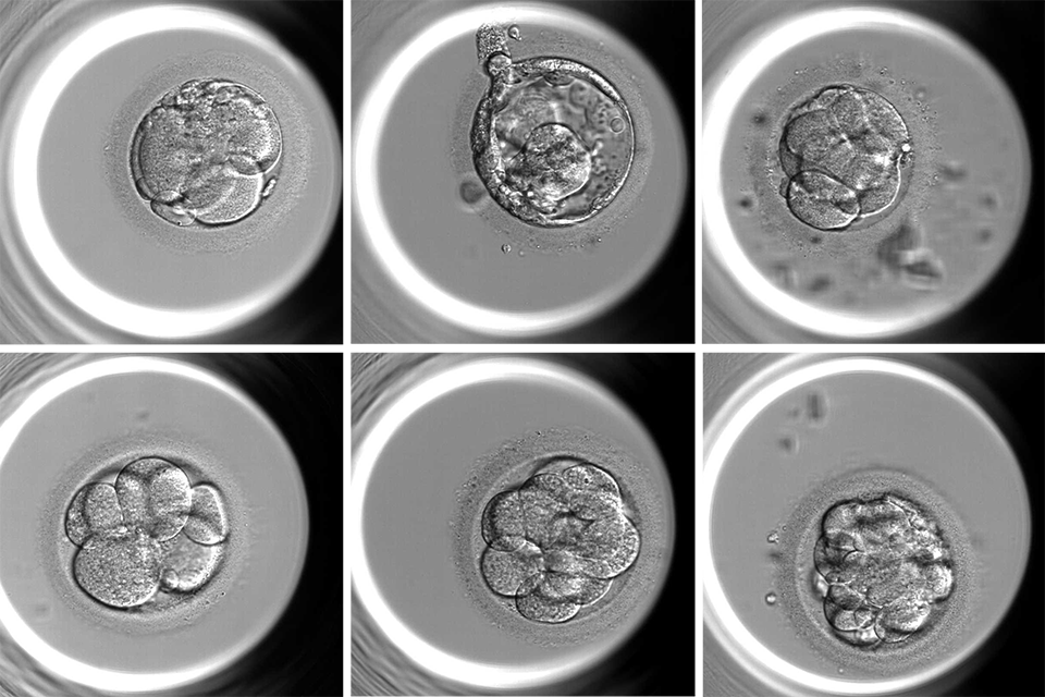 A Fully Automated AI-Based System for Assessing IVF Embryo Quality ...